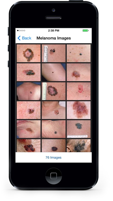 VisualDx | franzcalvo