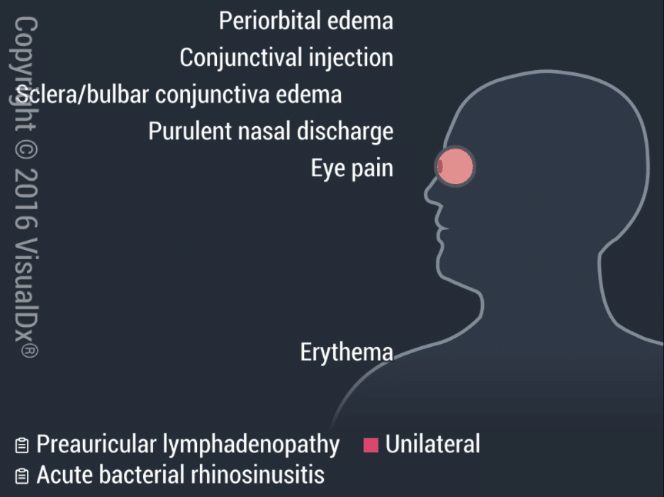 Woman’s Red Forehead Becomes Cellulitis Case, VisualDx Helps ER NP Add ...