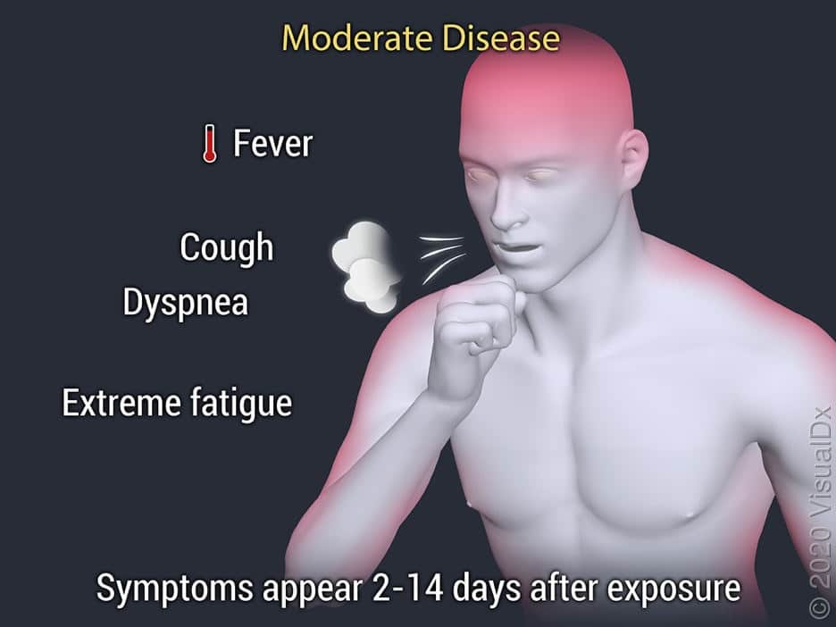 Coronavirus (COVID-19): What You Need to Know | VisualDx
