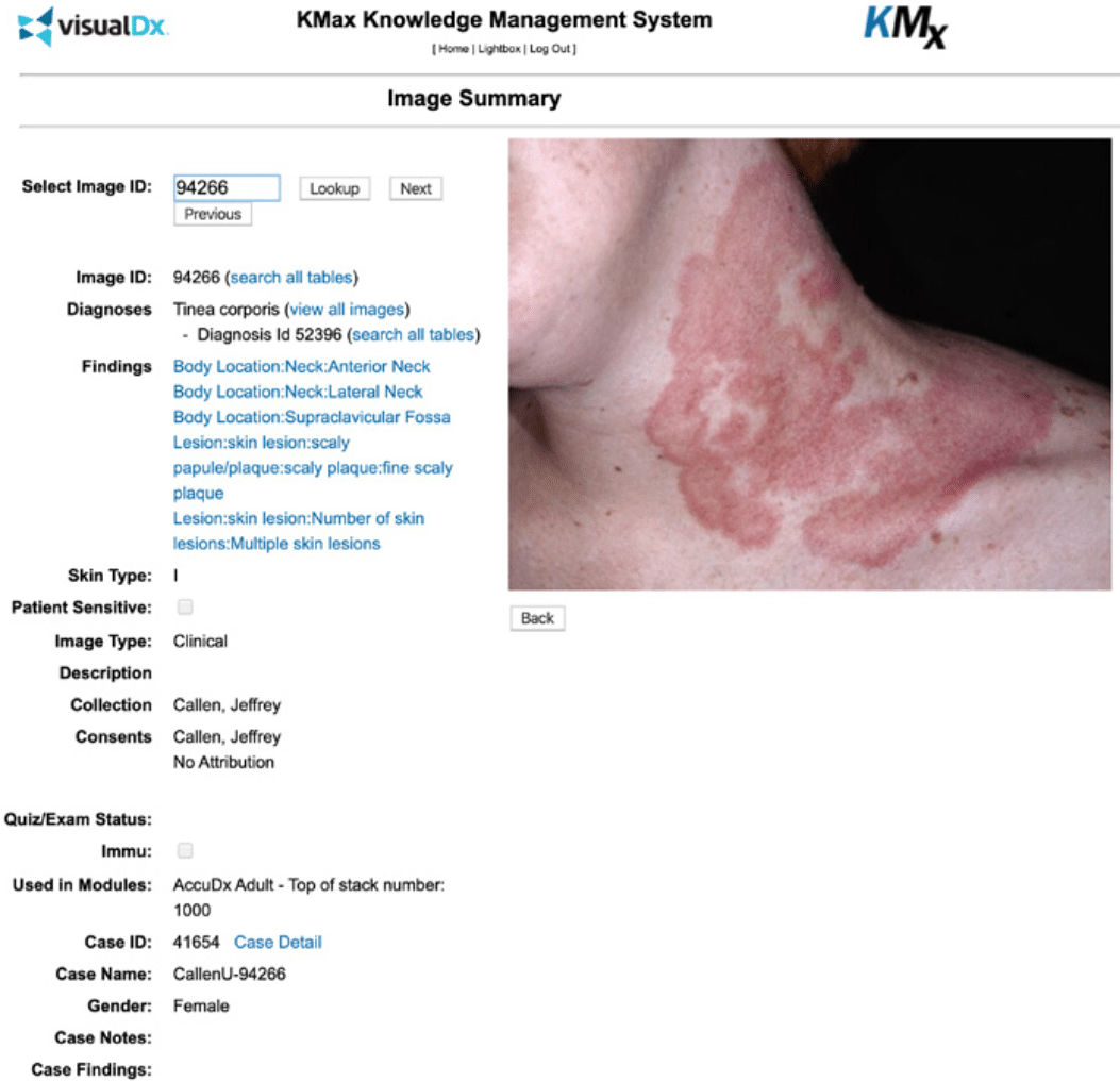 Image Collection | VisualDx