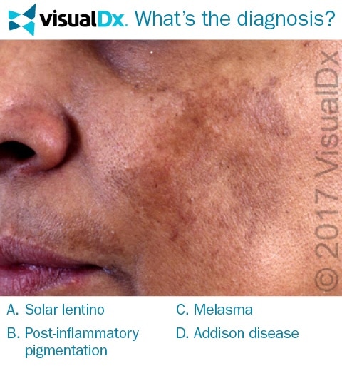 Woman Takes Contraceptives After Second Child, Develops Face Rash - Can ...