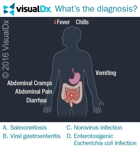 10 People Head to Hospital with Fever, Vomiting - Can You Diagnose the ...