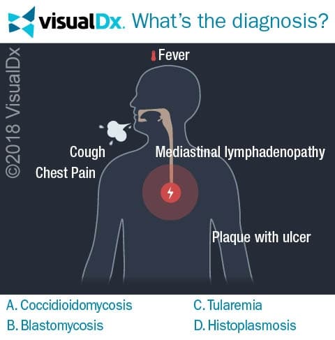 Man Suffers Flu-Like Symptoms after Costa Rica Trip - Let’s Diagnose ...