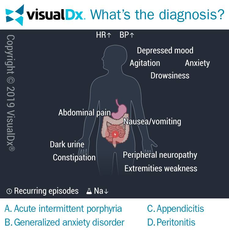 College Student Has Abdominal Pain and Thigh Rash - Let’s Diagnose ...