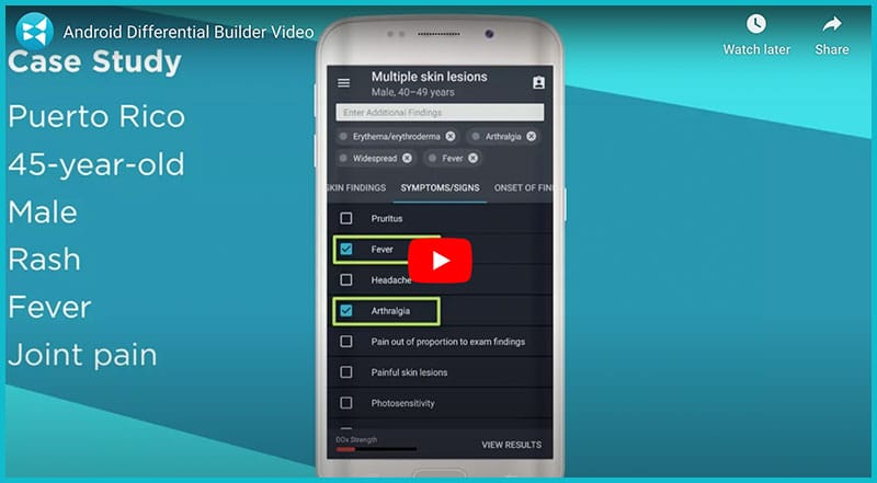 Tutorials | VisualDx