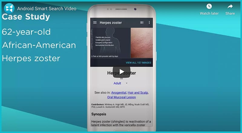 Tutorials | VisualDx