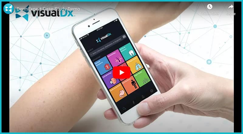 Tutorials | VisualDx
