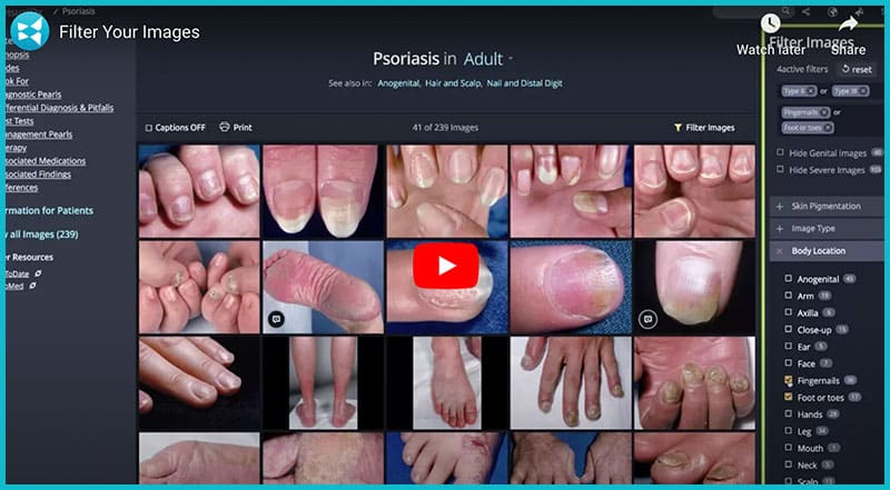 Tutorials | VisualDx