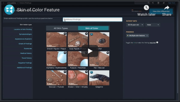 Tutorials | VisualDx