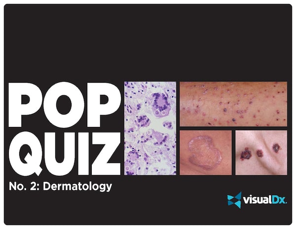 Medical Education | VisualDx