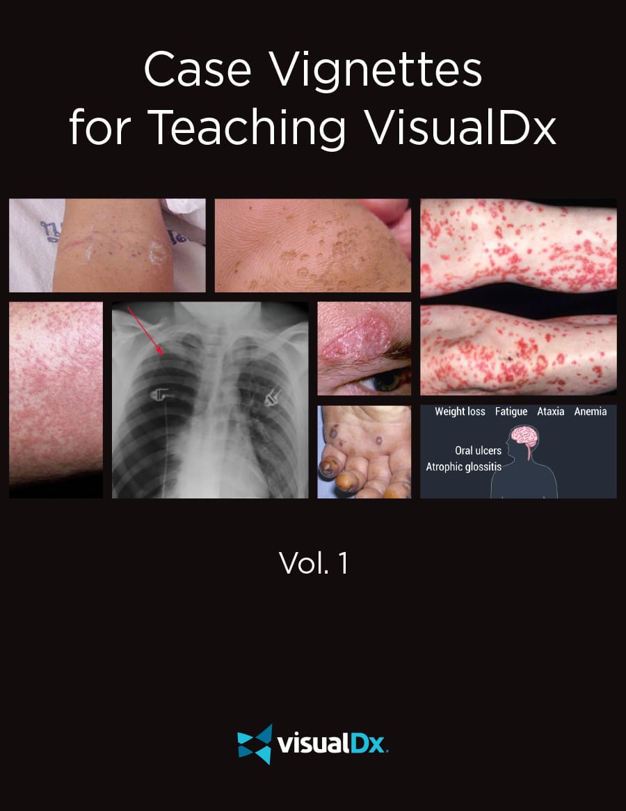 Medical Education | VisualDx