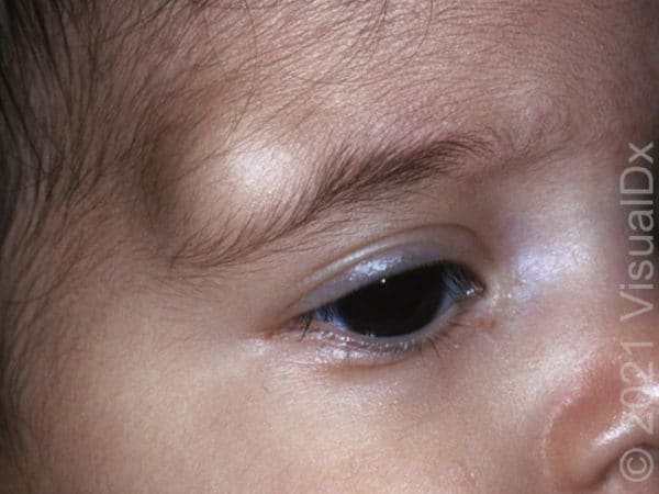 Resident Uses Image Collection to Help Diagnose Patient with Cyst