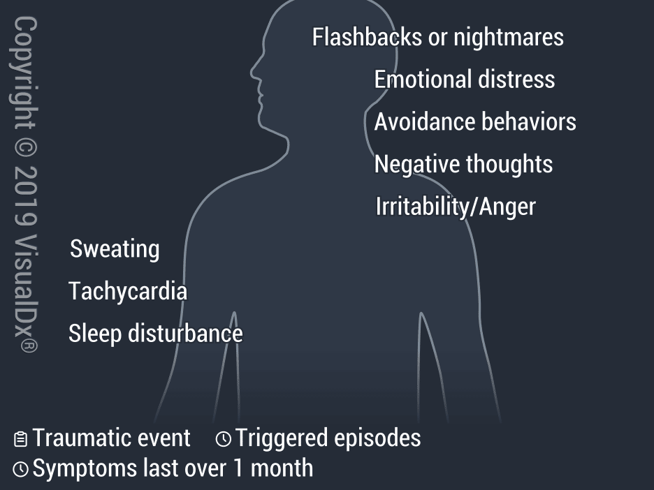 Posttraumatic Stress Disorder | VisualDx