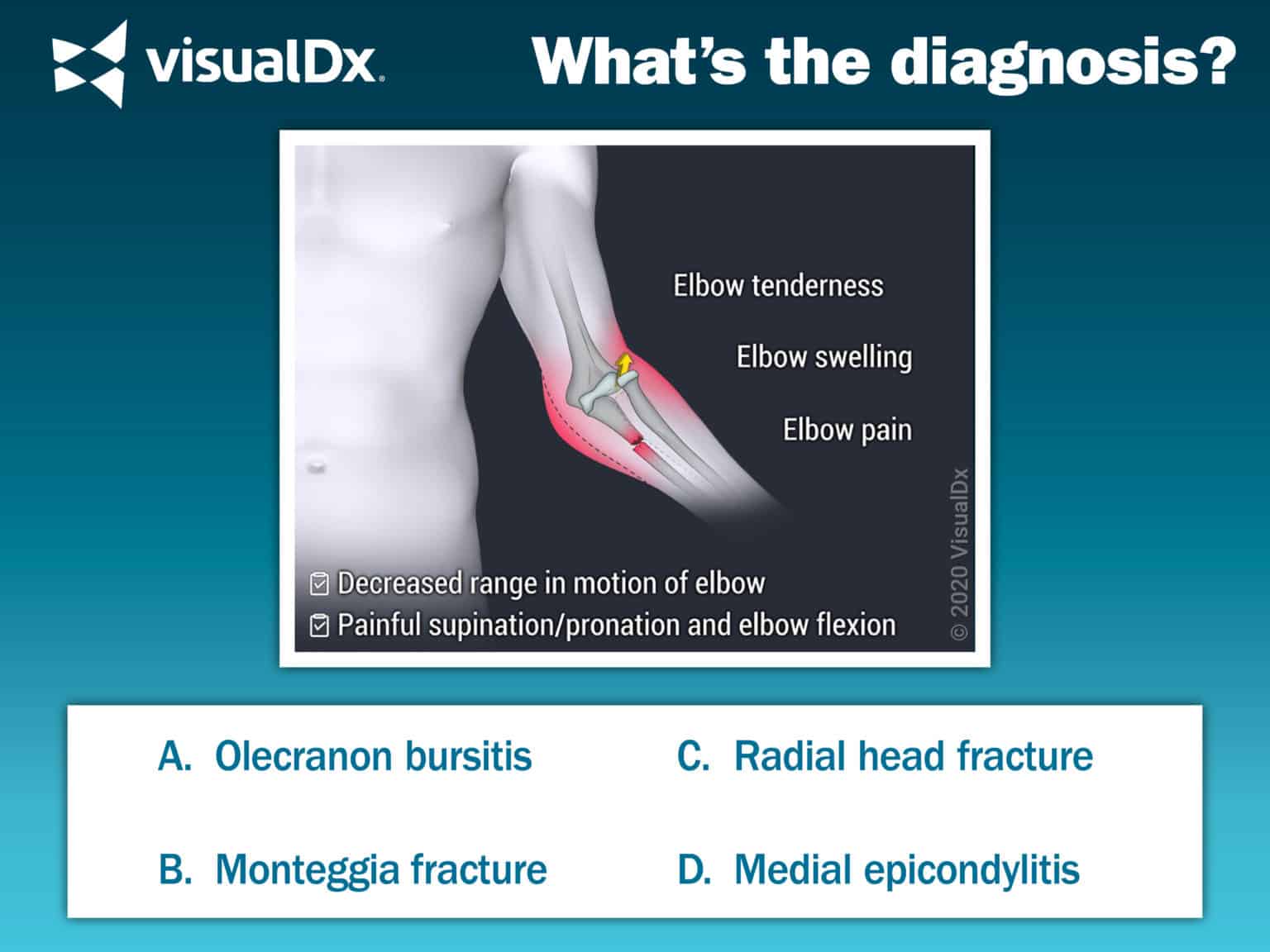 Man Has Elbow Pain, Edema Following Fall - Let’s Diagnose