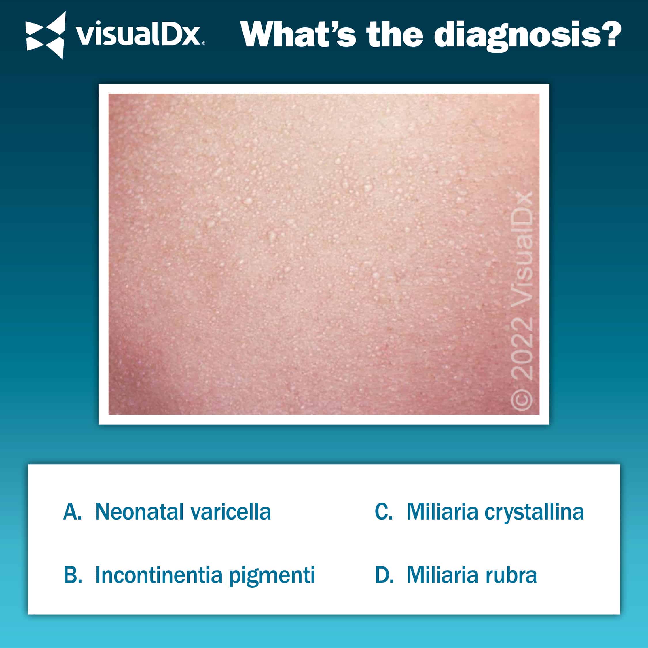 VisualDx | Visual Clinical Decision Support System (CDSS)