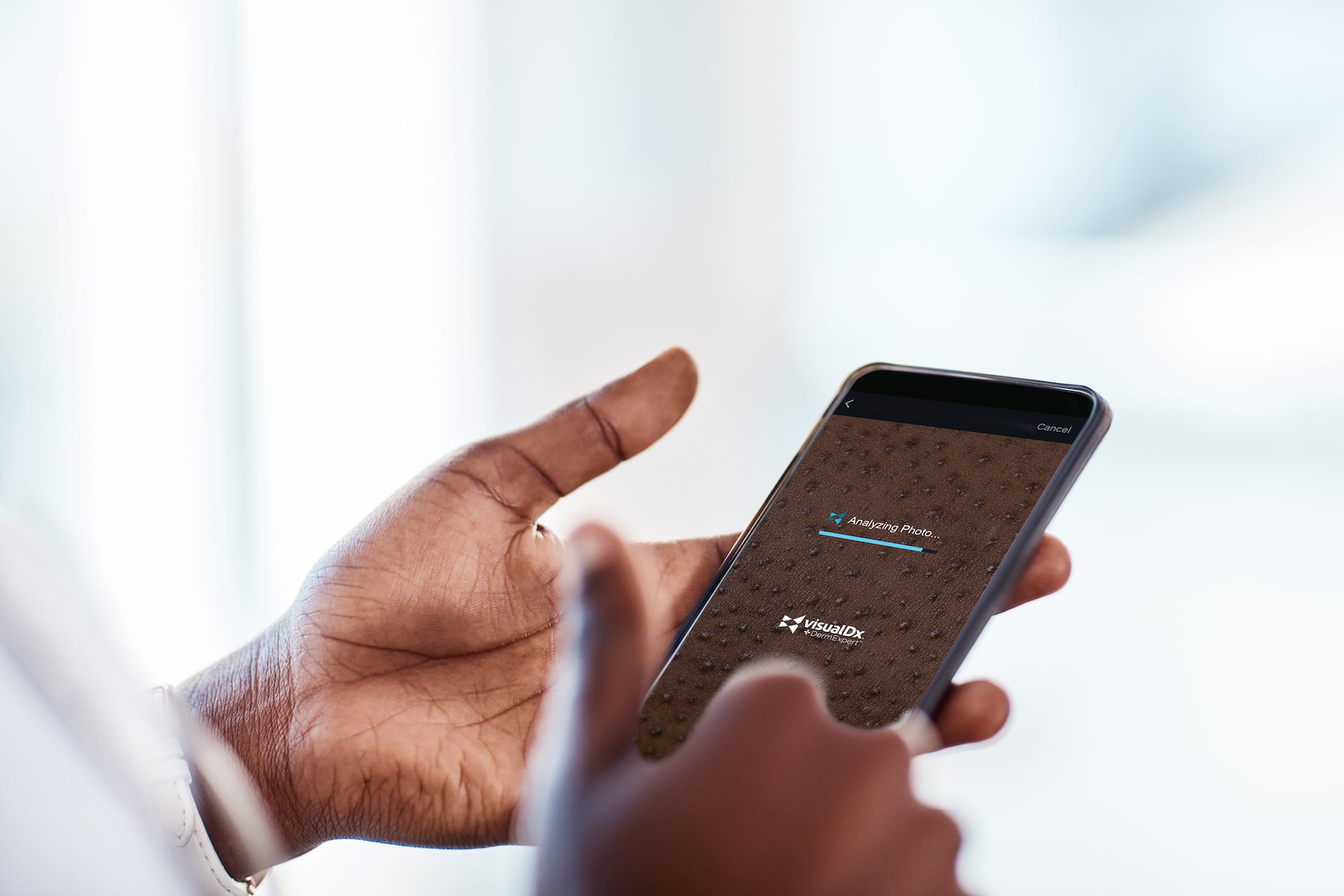 DermExpert™ | VisualDx