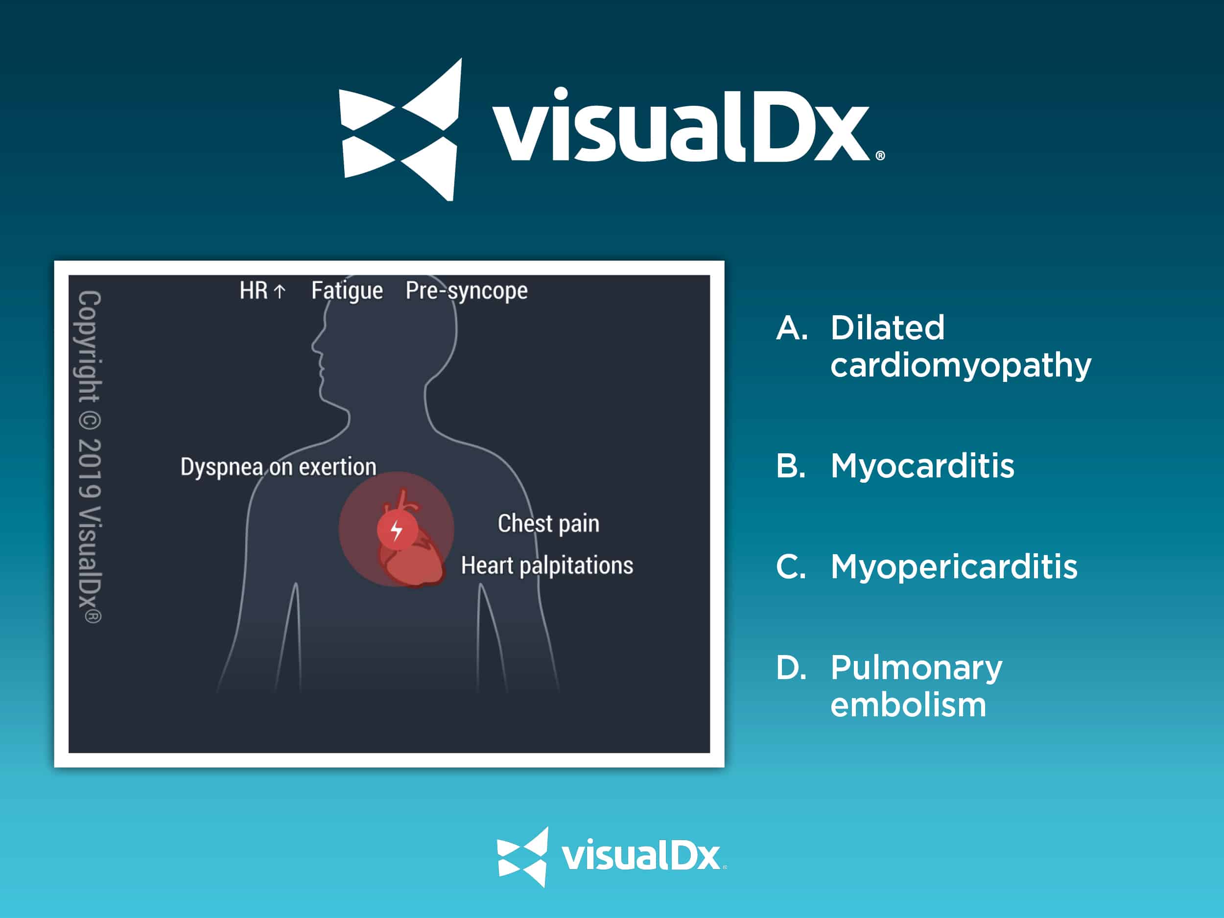 Woman has sudden-onset tachycardia, chest pain - Let’s diagnose | VisualDx