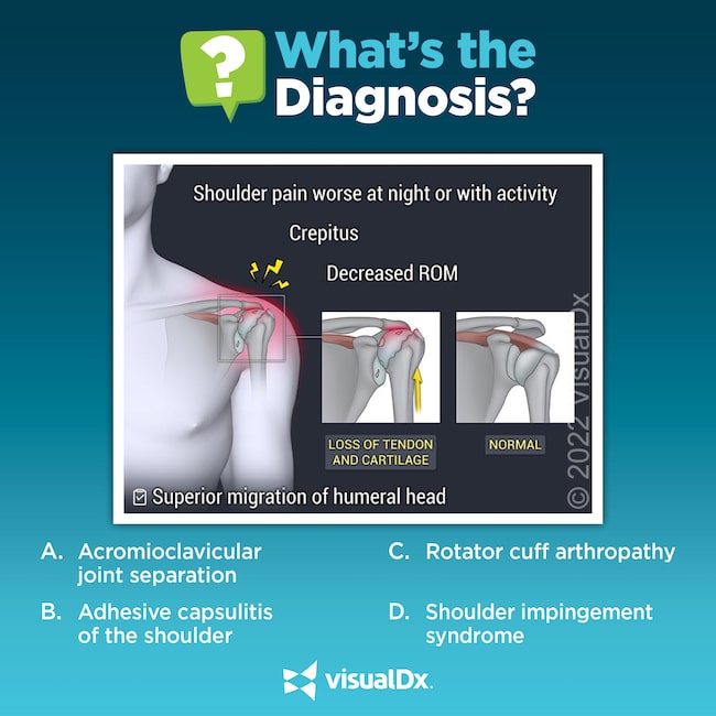 A lifetime of labor resulting in shoulder pain. Let’s diagnose. | VisualDx