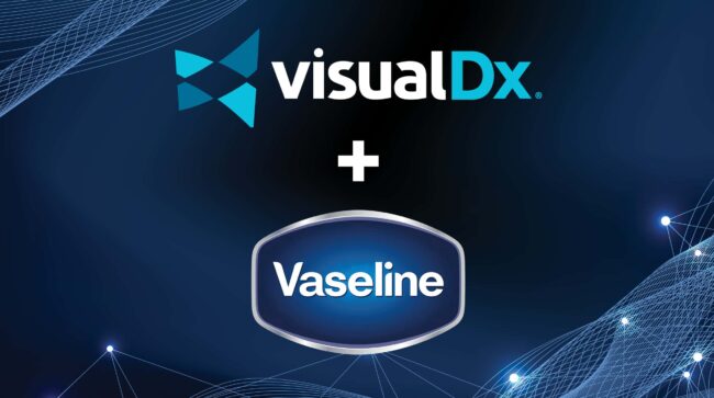 VisualDx Partners with Vaseline ® to Advance Education on Treating Skin ...