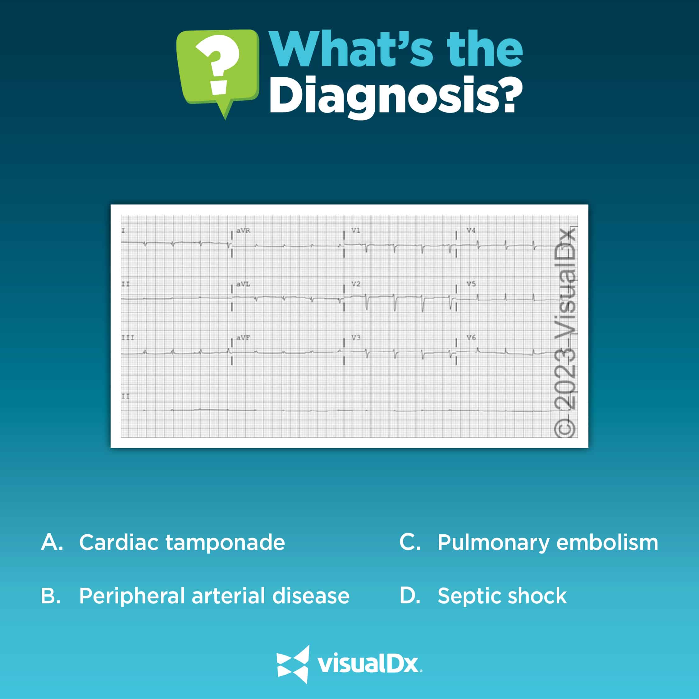 Check out this ECG and patient symptoms. Do you know the diagnosis? | VisualDx