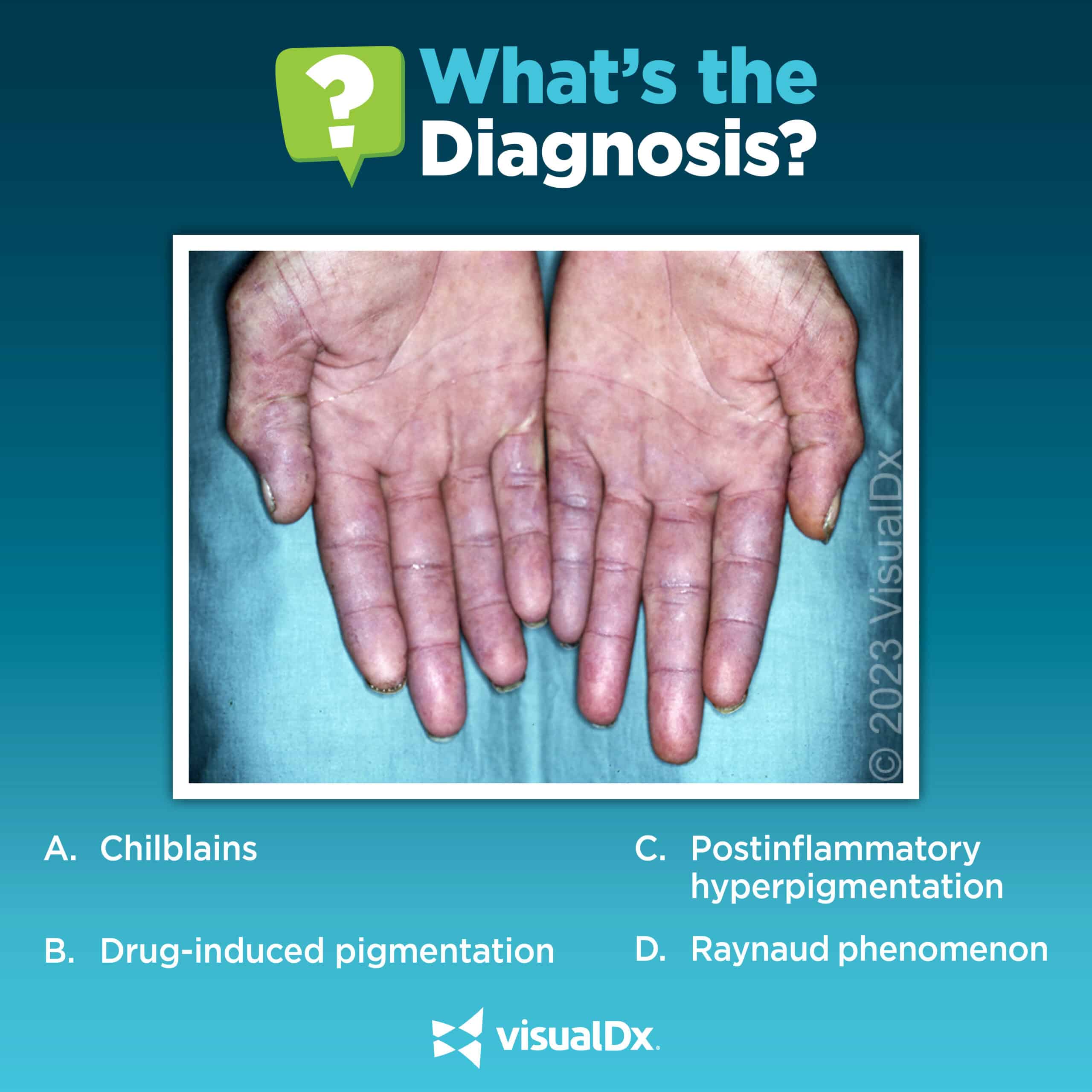 Changing colors on her fingers. Can you solve the image challenge ...