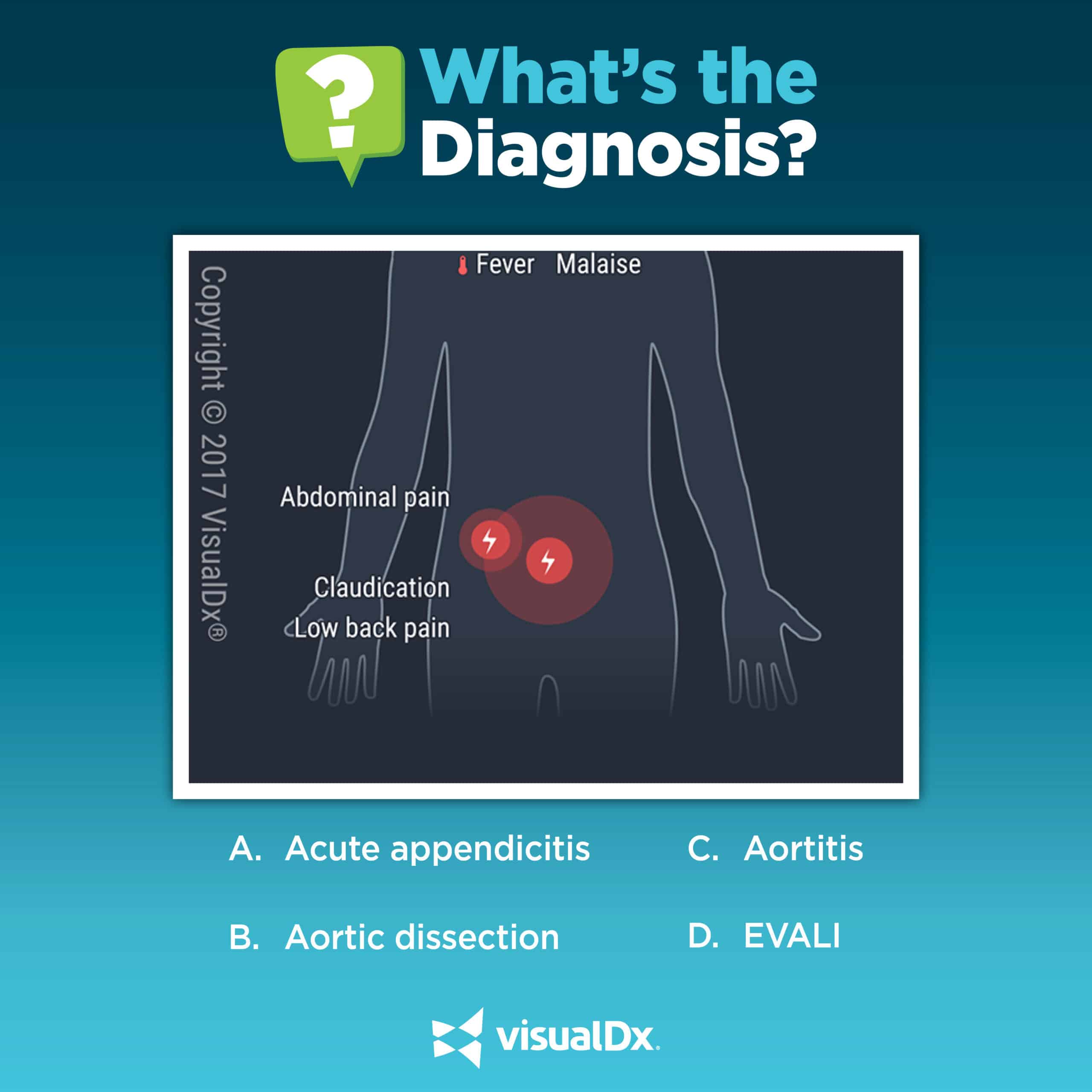 A patient presents to the ED with fever, malaise, and low back pain ...