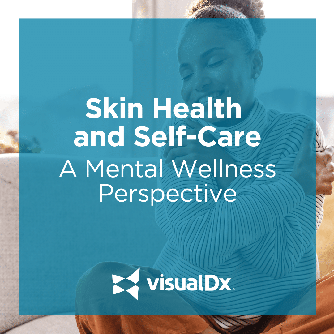 Skin Health and Self-Care: A Mental Wellness Perspective | VisualDx