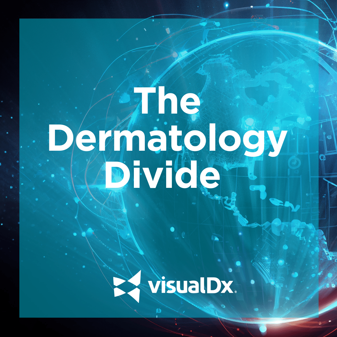 The Dermatology Divide: Tackling Barriers to Care Globally | VisualDx
