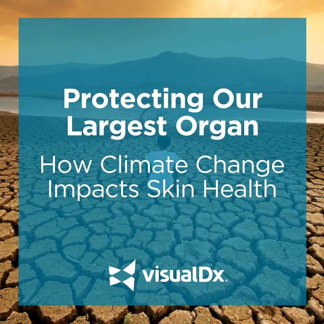 Protecting Our Largest Organ: How Climate Change Impacts Skin Health | VisualDx