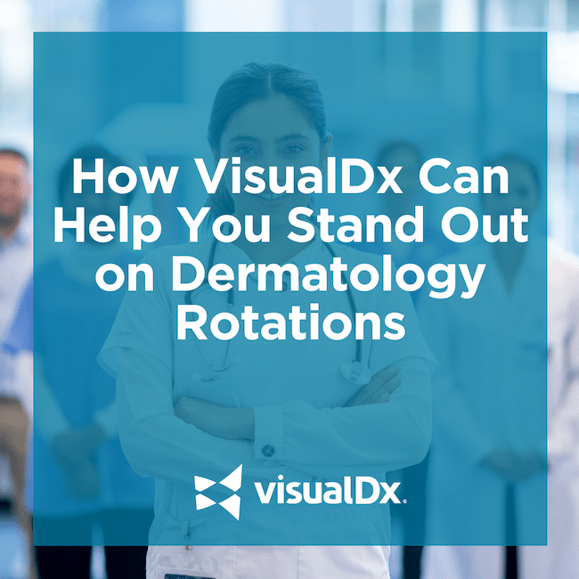 How VisualDx Can Help You Stand Out on Dermatology Rotations | VisualDx