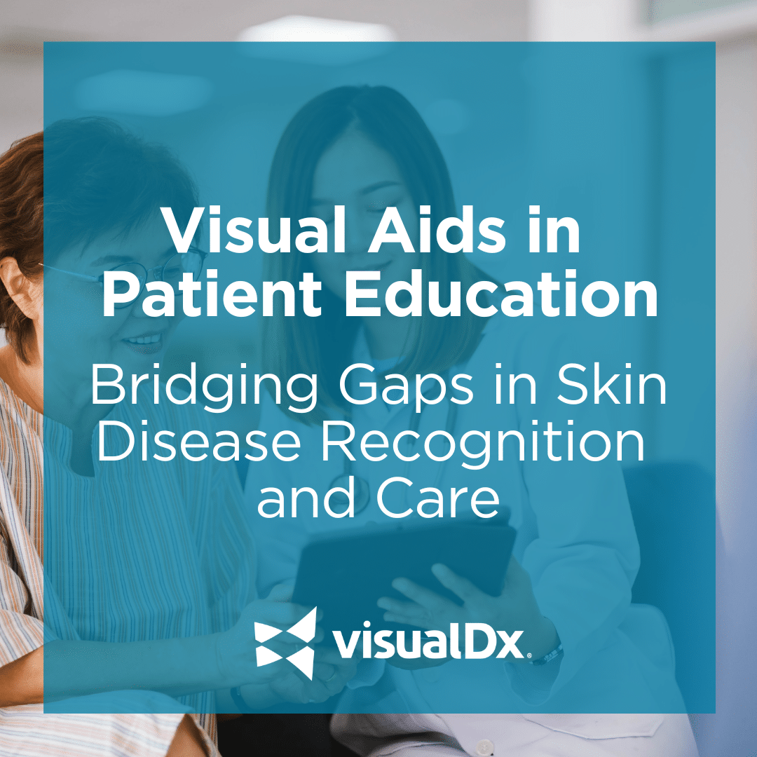 Visual Aids in Patient Education: Bridging Gaps in Skin Disease Recognition and Care | VisualDx