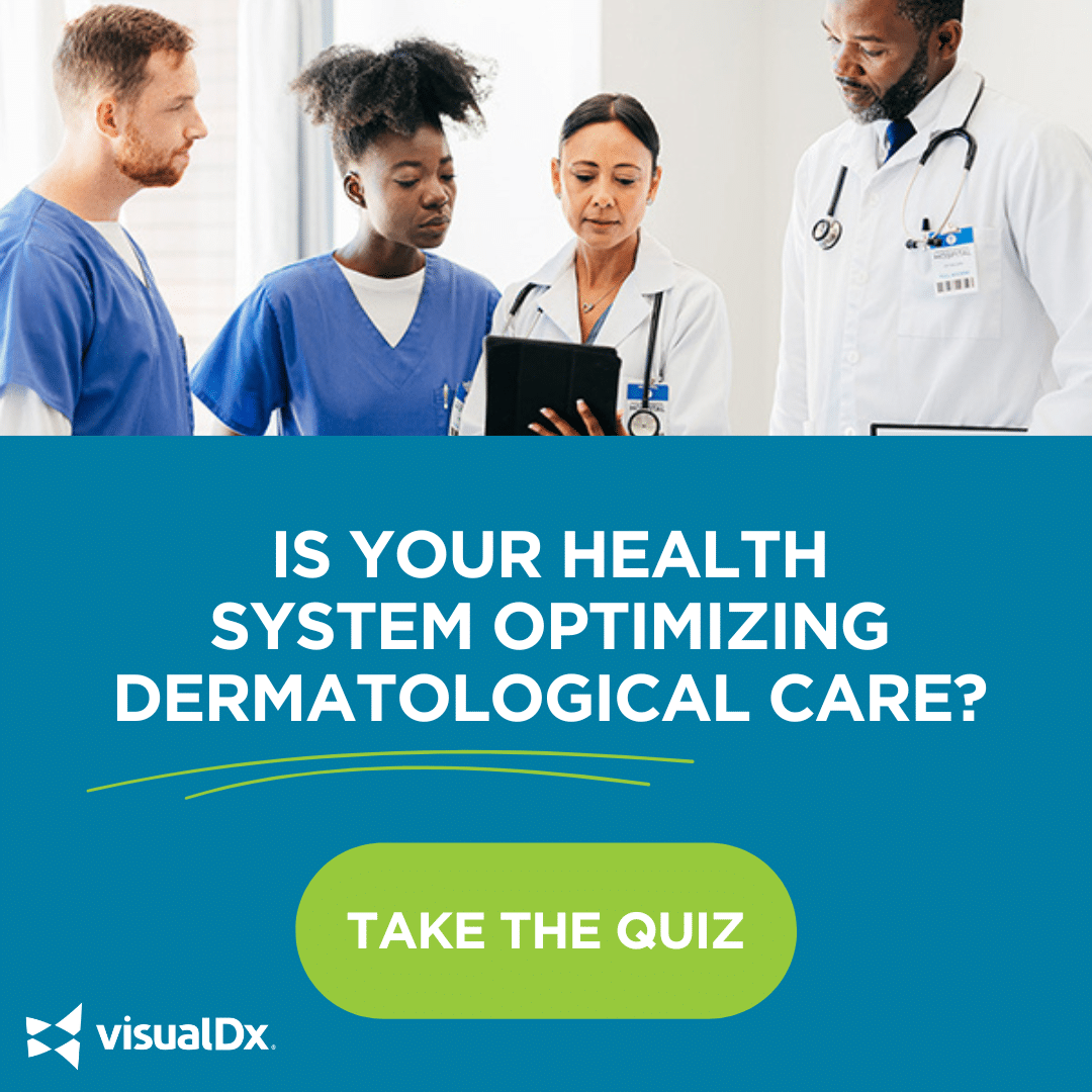 Quiz-Health System Optimization | VisualDx