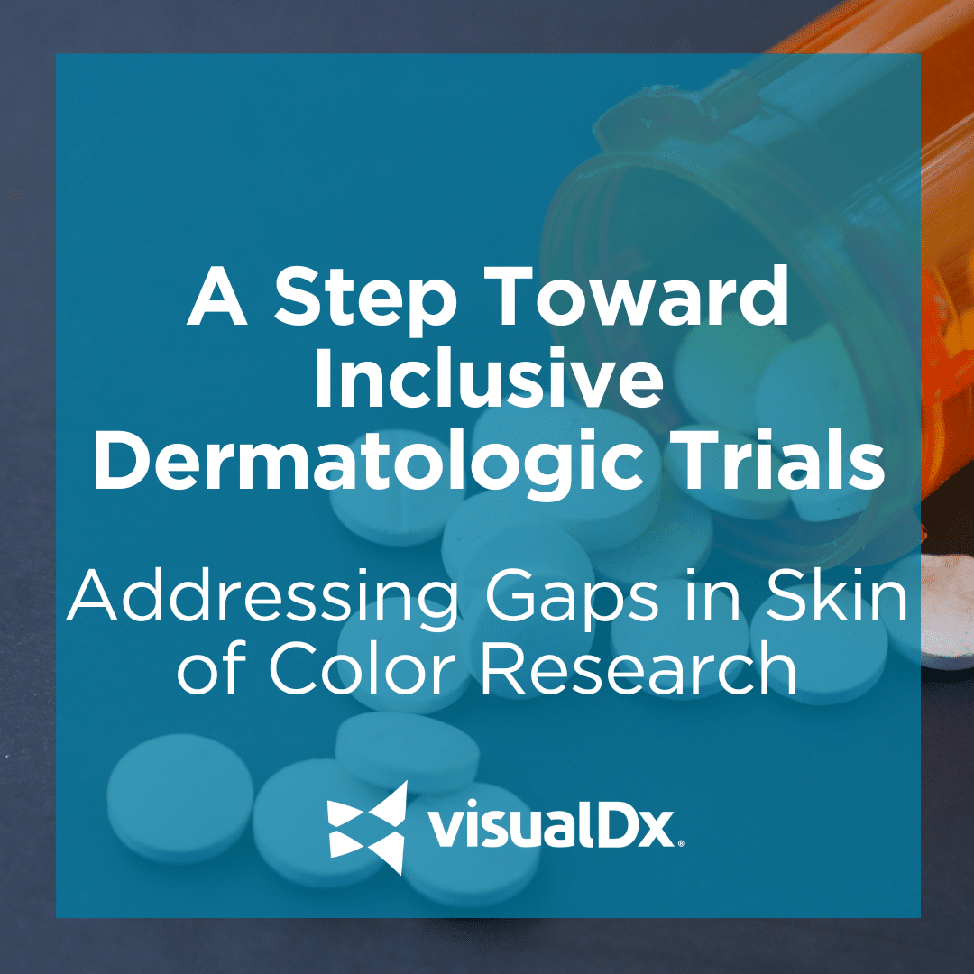 A Step Toward Inclusive Dermatologic Trials: Addressing Gaps in Skin of ...
